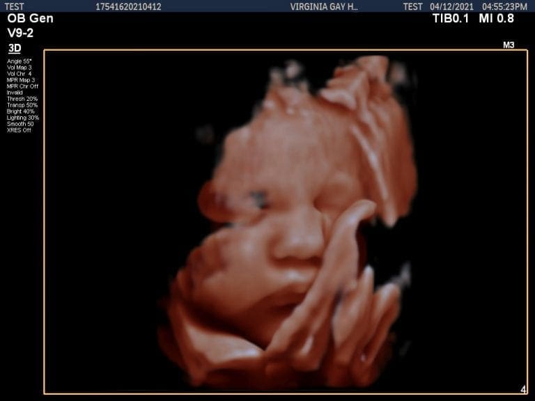 Imaging Services - Virginia Gay